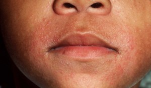 xérose – HelloTitoune